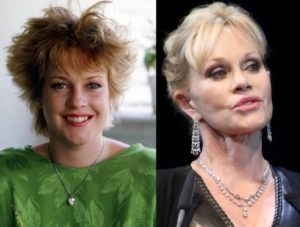Melanie Griffith Before and After Plastic Surgery: Face, Eyes, Lips