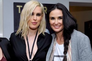 Rumer Willis Before and After Plastic Surgery: Chin, Eyes, Lips