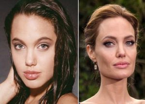 Angelina Jolie Before and After Plastic Surgery: lips, nose, boobs