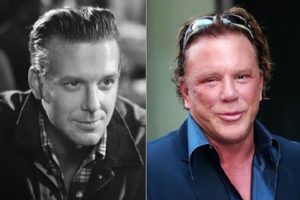 Mickey Rourke Before and After Plastic Surgery: Face, Hair