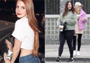 Lana Del Rey Before and After Plastic Surgery: Nose, Lips