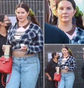 Lana Del Rey Before and After Plastic Surgery: Nose, Lips