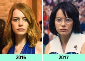Emma Stone Before and After Plastic Surgery