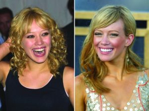 Hilary Duff Before and After Plastic Surgery: Boob, Nose, Lips