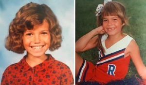 Mandy Moore Before and After Plastic Surgery