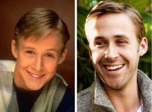 Ryan Gosling Before and After Plastic Surgery: Nose, Teeth