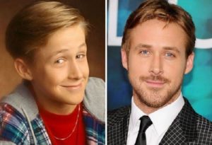 Ryan Gosling Before and After Plastic Surgery: Nose, Teeth