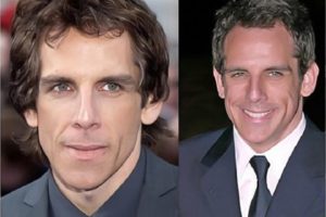 Ben Stiller Before and After Plastic Surgery: Ears, Nose, Face