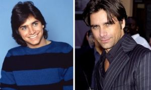 John Stamos Before and After Plastic Surgery: Facelift, Botox