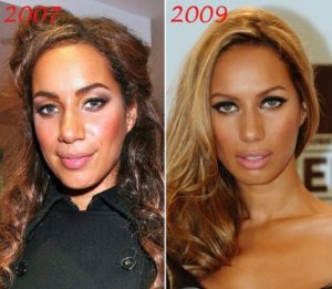 Leona Lewis Before and After Plastic Surgery: Nose, Face, Breast