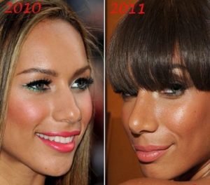 Leona Lewis Before and After Plastic Surgery: Nose, Face, Breast