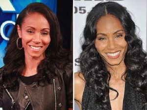 Jada Pinkett Smith Before and After Plastic Surgery