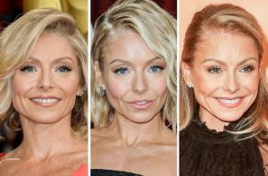 Kelly Ripa Before and After Plastic Surgery: Nose, Boob, Botox, Facelift